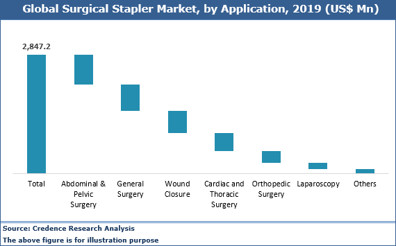 Surgical Stapler Market, Share, Trend, Analysis And Forecast To 2027